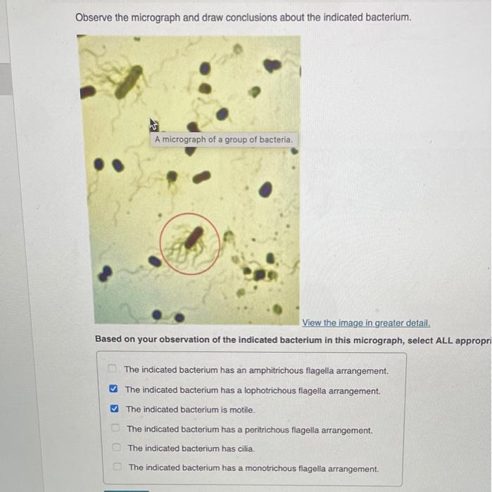 Solved Observe the micrograph and draw conclusions about the | Chegg.com