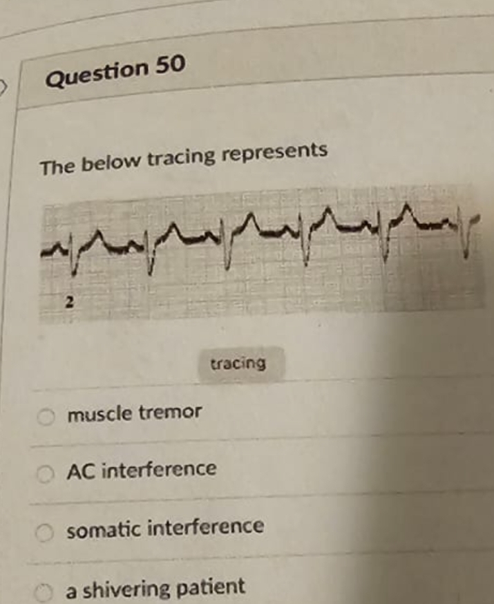 Solved by an EXPERT Question 50The below tracing represents muscle ...