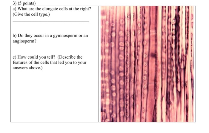 Solved 3) (5 points) a) What are the elongate cells at the | Chegg.com