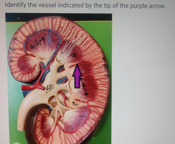 Solved Identify the vessel indicated by the tip of the | Chegg.com