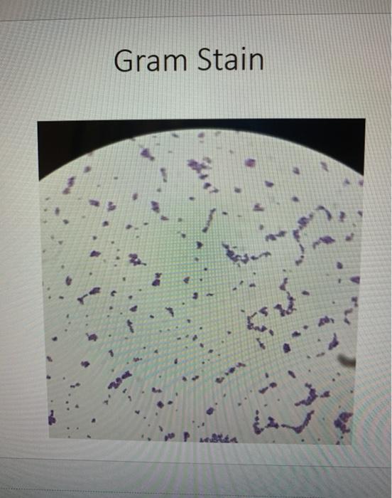 Solved Gram Stain Catalase Test Cytochrome Oxidase | Chegg.com