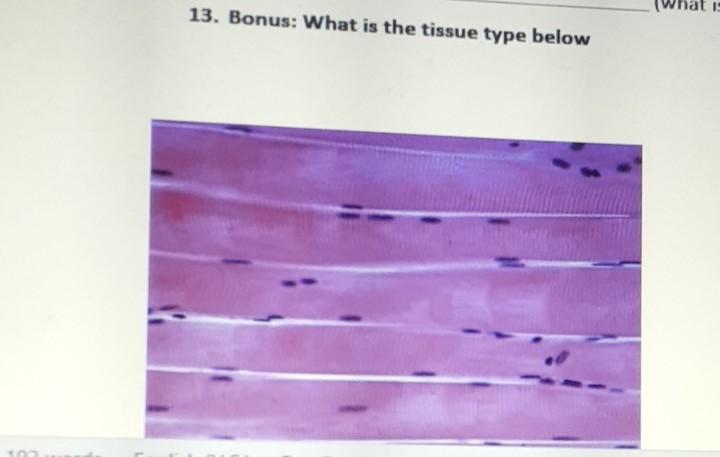 Solved 13. Bonus: What is the tissue type below what is | Chegg.com