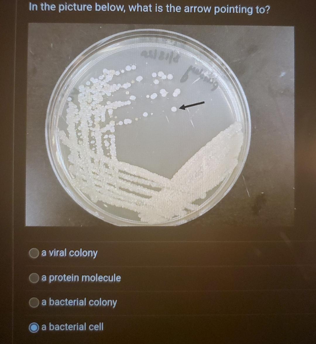 Solved In the picture below, what is the arrow pointing to?a | Chegg.com