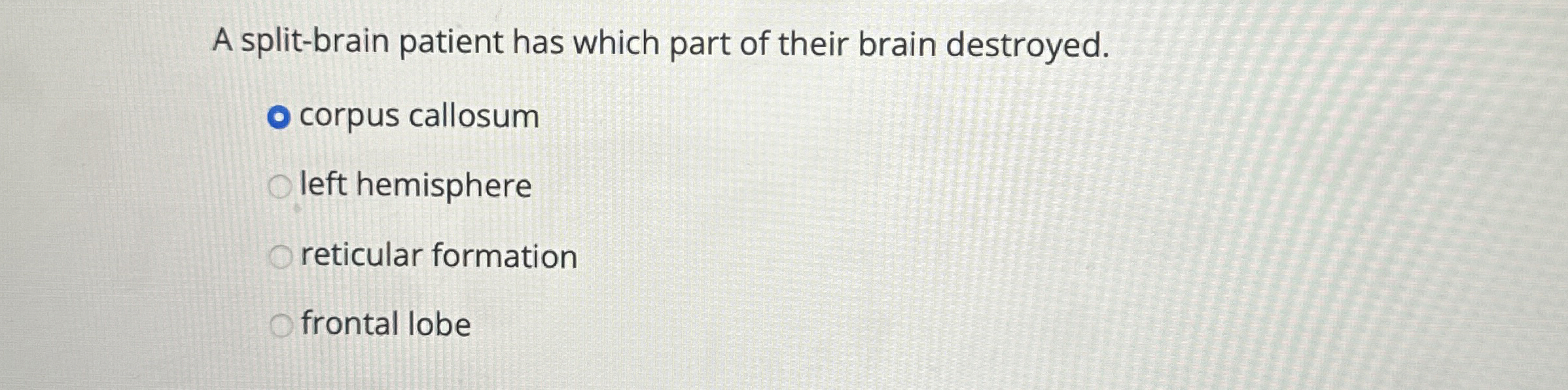 Solved A split-brain patient has which part of their brain | Chegg.com