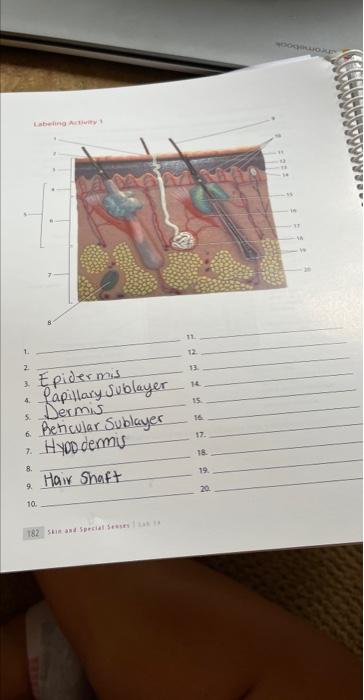 Solved Epidermis 13 4. Papillary Sublayer u Dermis is. - | Chegg.com