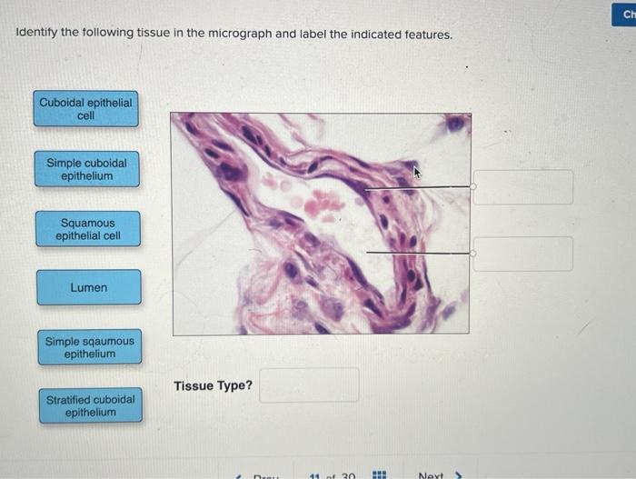 Solved Identify the following tissue in the micrograph and | Chegg.com