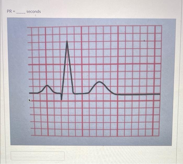 Solved PR = seconds Identify wave/deflection labeled A. | Chegg.com
