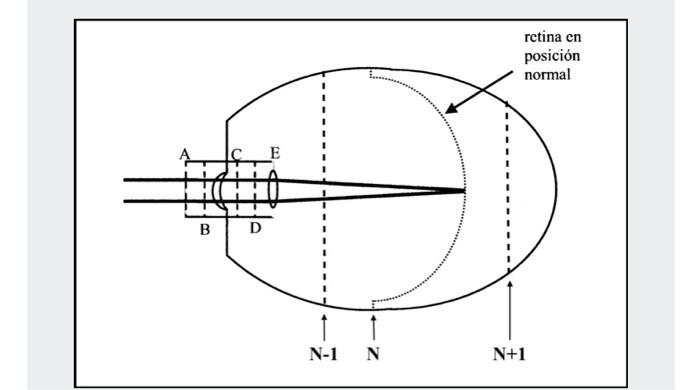 Solved In the Human Eye experiment a group of students tried | Chegg.com