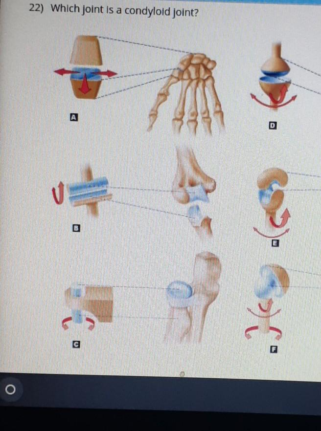 Solved 22) Which joint is a condyloid joint? D on . | Chegg.com