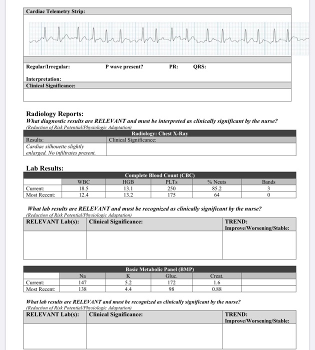 Cardiac Telemetry Strip: hhhhhhhhhhhhhhhh P wave | Chegg.com