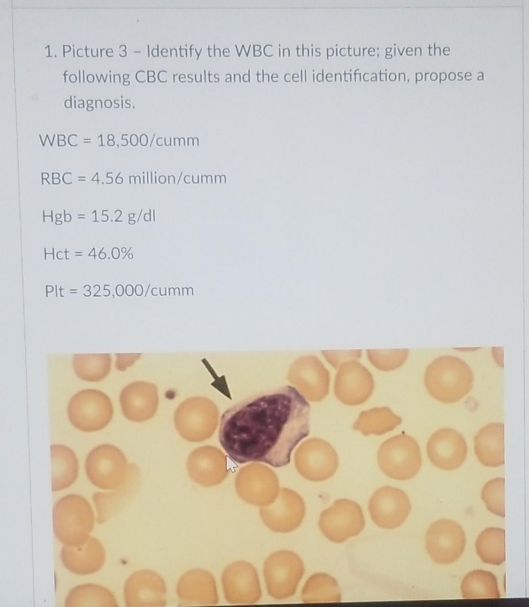 Solved 1. Picture 3 - Identify the WBC in this picture; | Chegg.com