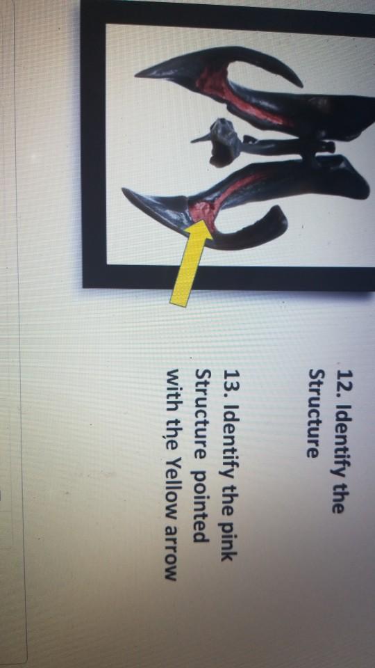 Solved 9. Identify the structure pointed with the Red arrow | Chegg.com