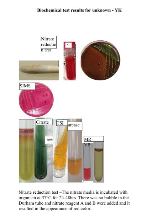 Biochemical test results for unknown - YK Nitrate | Chegg.com