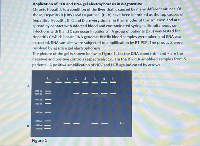 Solved A B Application of PCR and DNA gel electrophoresis in | Chegg.com