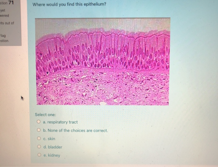 Solved Where would you find this epithelium? stion 71 yet | Chegg.com Solved Where would you find this epithelium? stion 71 yet | Chegg.com