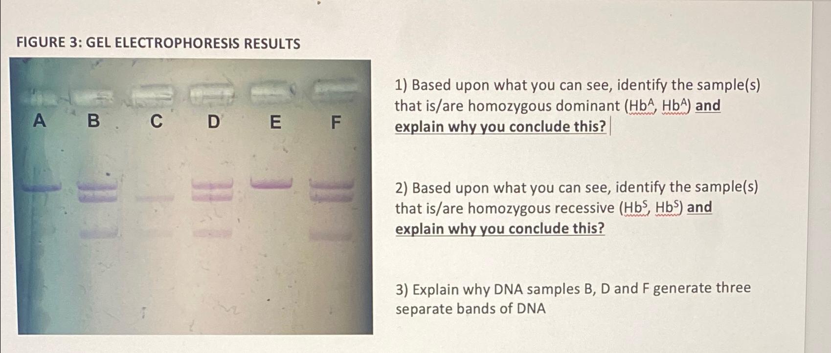 Solved FIGURE 3: GEL ELECTROPHORESIS RESULTSBased upon what | Chegg.com