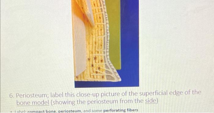 Solved 7. Endosteum; label this close-up picture of the | Chegg.com