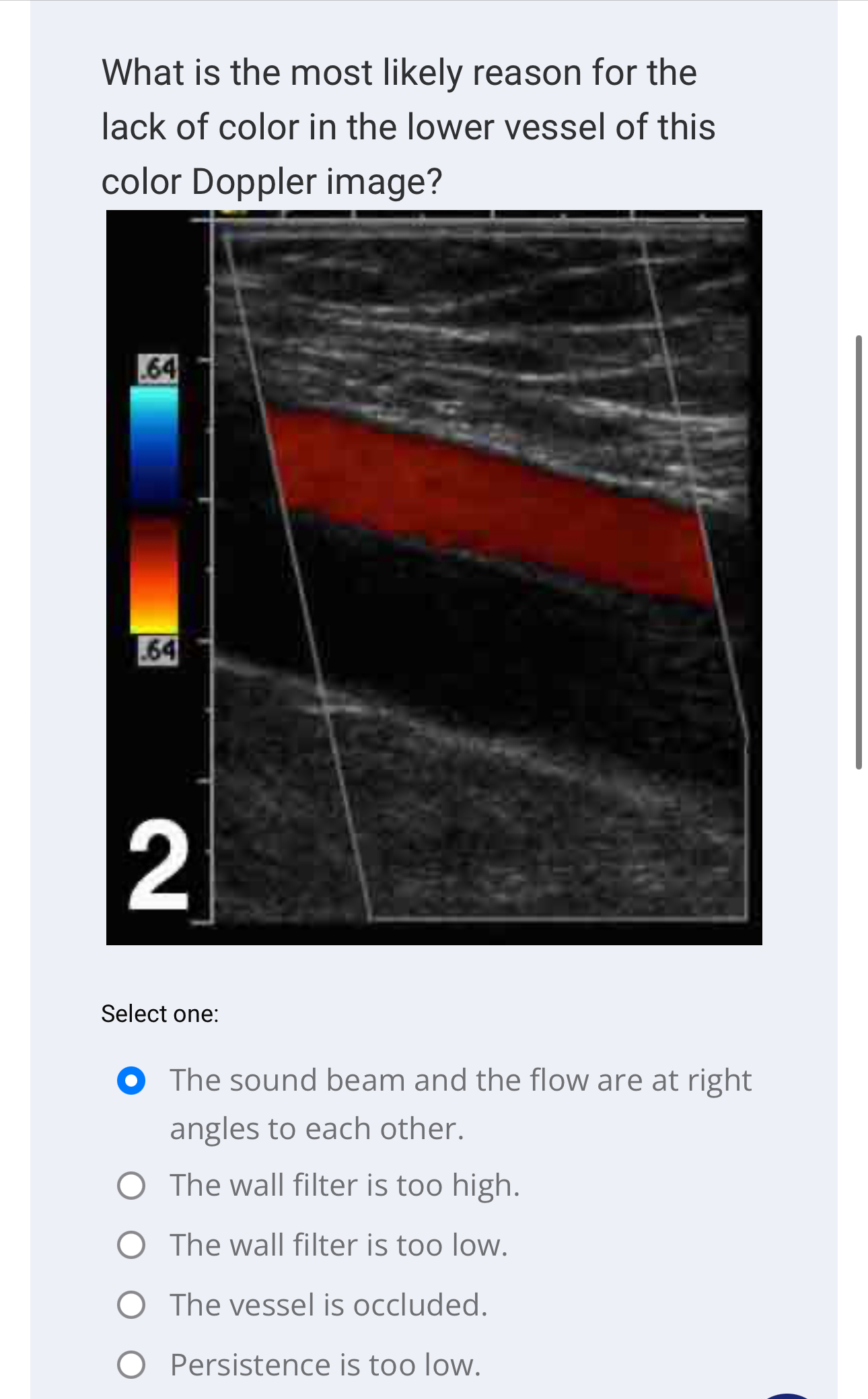 Solved What is the most likely reason for the lack of color | Chegg.com