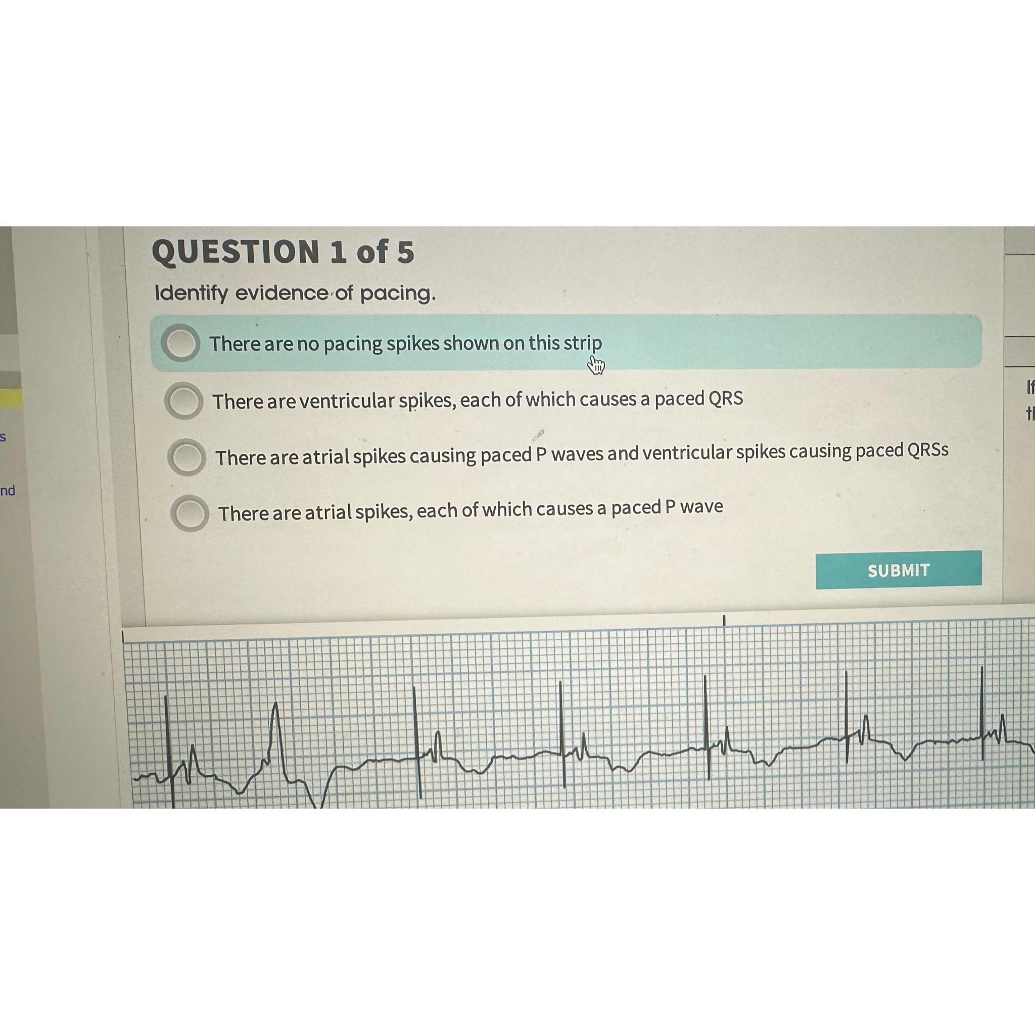 Solved QUESTION 1 ﻿of 5Identify evidence of pacing.There are | Chegg.com
