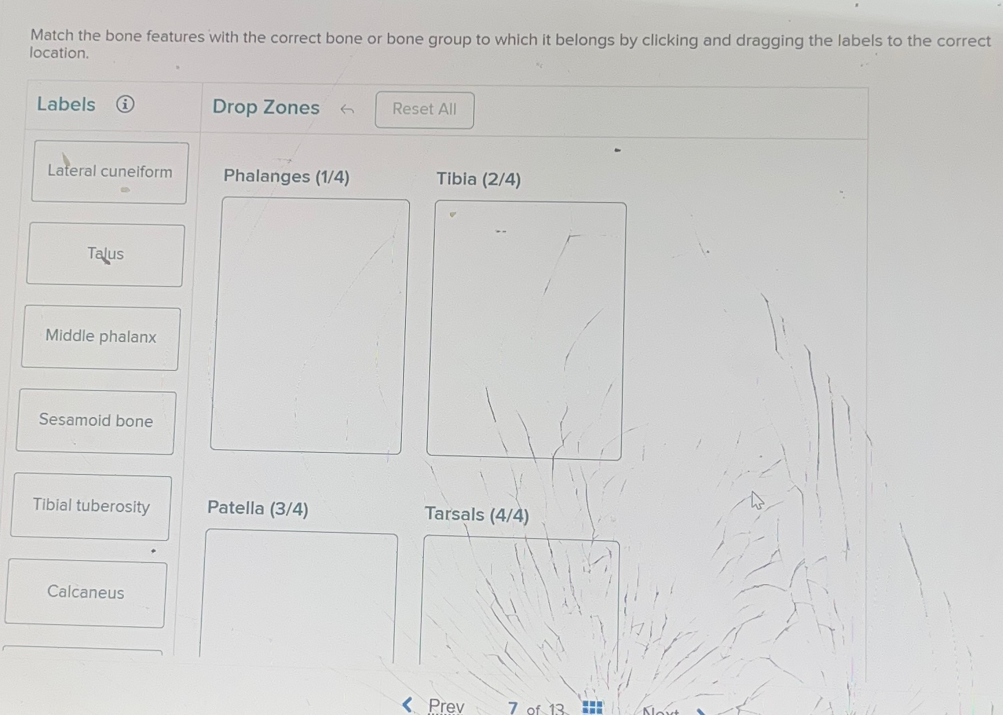 Solved Match the bone features with the correct bone or bone | Chegg.com
