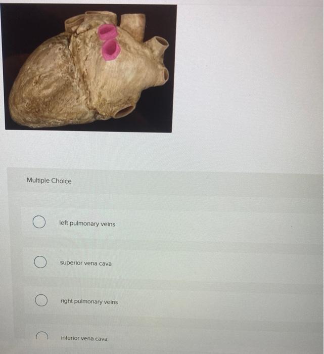 Solved Multiple Choice left pulmonary veins superior vena | Chegg.com