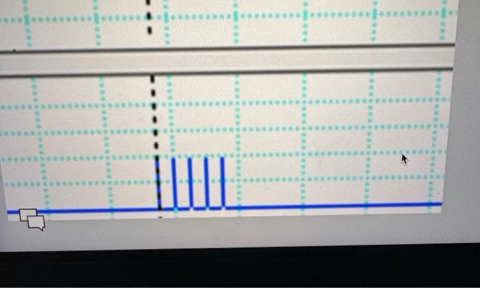 Label the contraction phase as "A," the latent period | Chegg.com