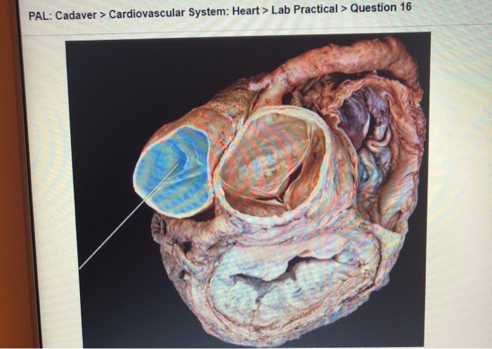PAL: Cadaver > Cardiovascular System: Heart > Lab | Chegg.com