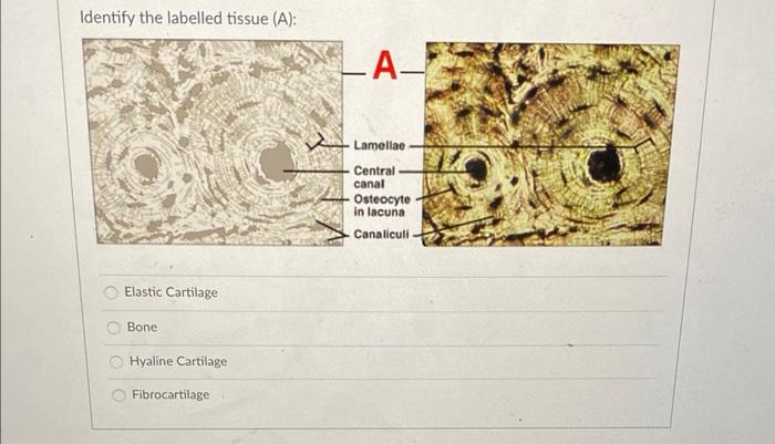 Solved Identify the labelled epithelium (A): Simple cuboidal | Chegg.com