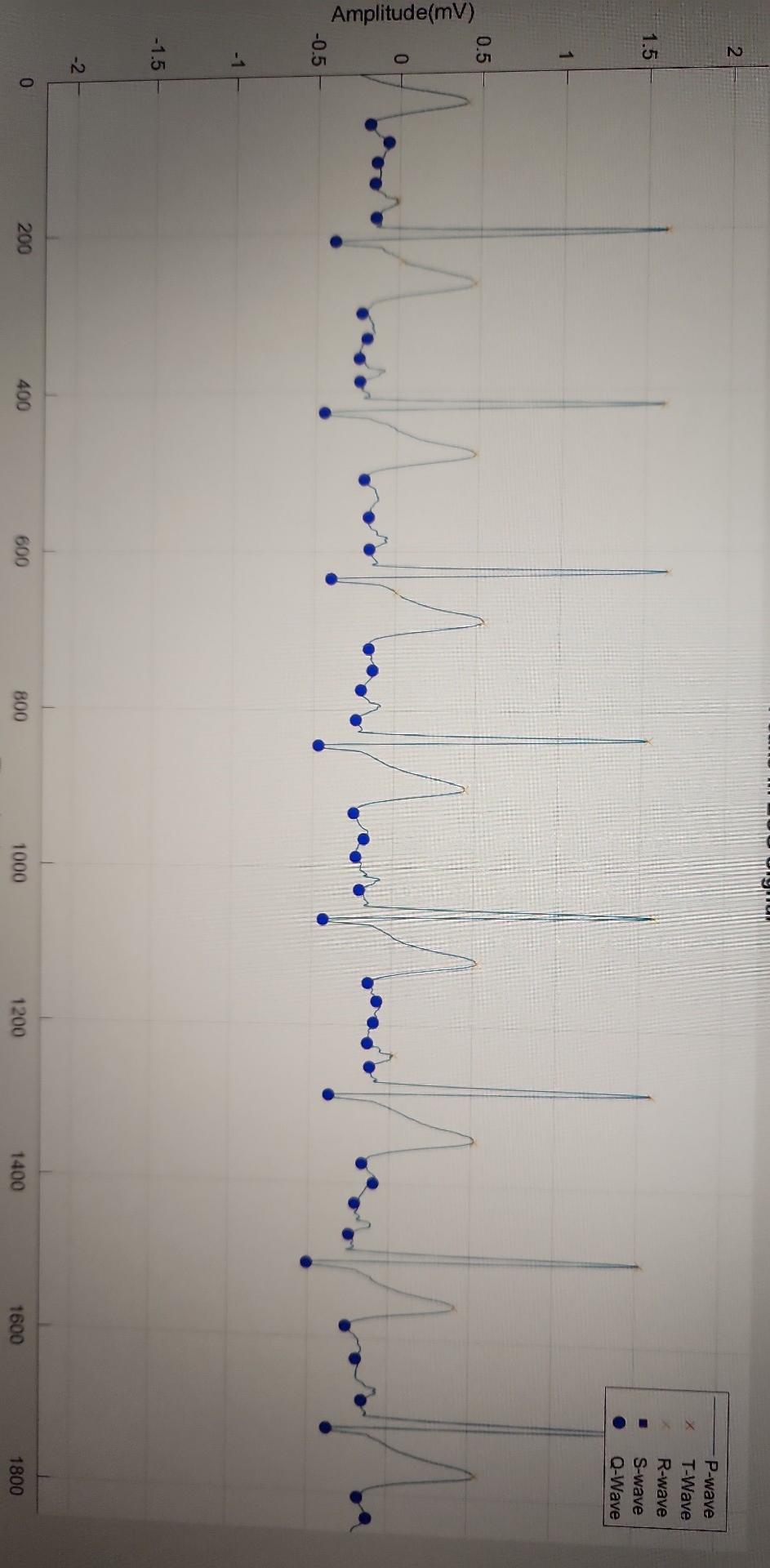 Solved I used this code in MATLAB to detect QRST peaks in an | Chegg.com