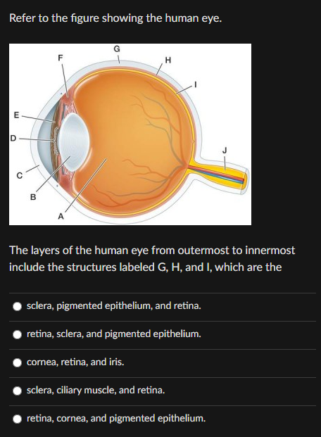 Solved Refer to the figure showing the human eye.The layers | Chegg.com