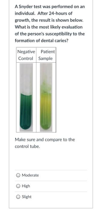 A Snyder test was performed on an individual. After | Chegg.com