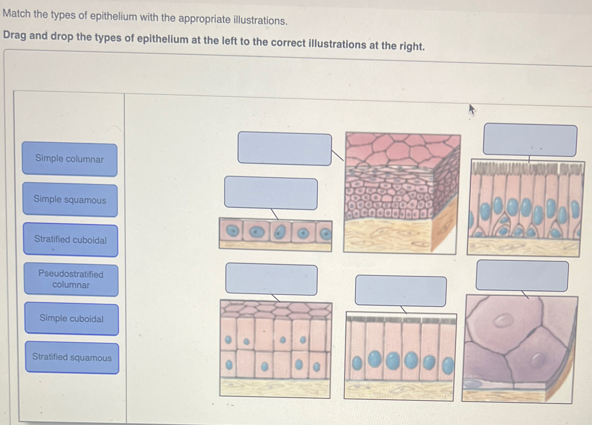 Solved Match the types of epithelium with the appropriate | Chegg.com