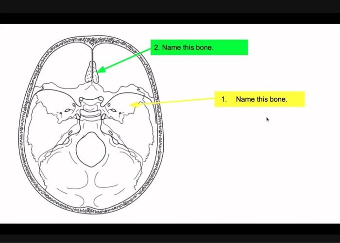Solved 1. Name this bone. | Chegg.com