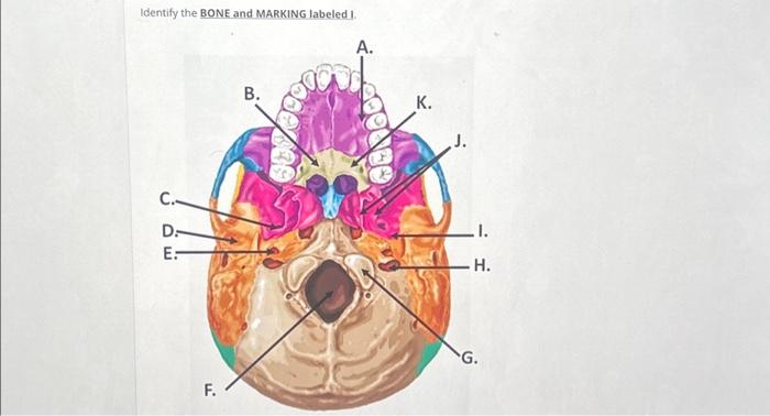 Solved Identify the BONE and MARKING labeled I. C.- DE D. E- | Chegg.com