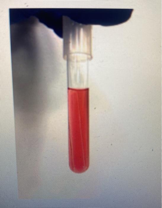 Solved Below is a photo of an uninoculated phenol red broth. | Chegg.com