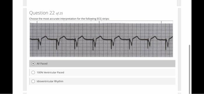 Solved AY Paced 100M Ventricular Paced Idicoventricular | Chegg.com