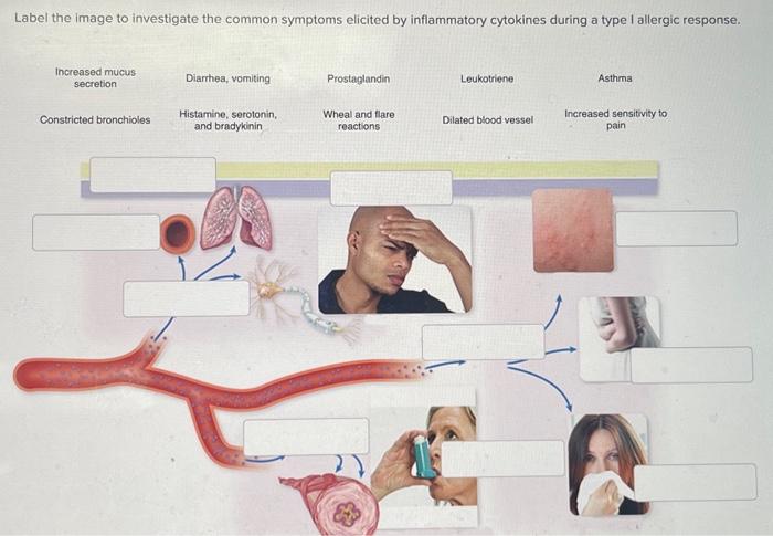 Solved Label the image to investigate the common symptoms | Chegg.com