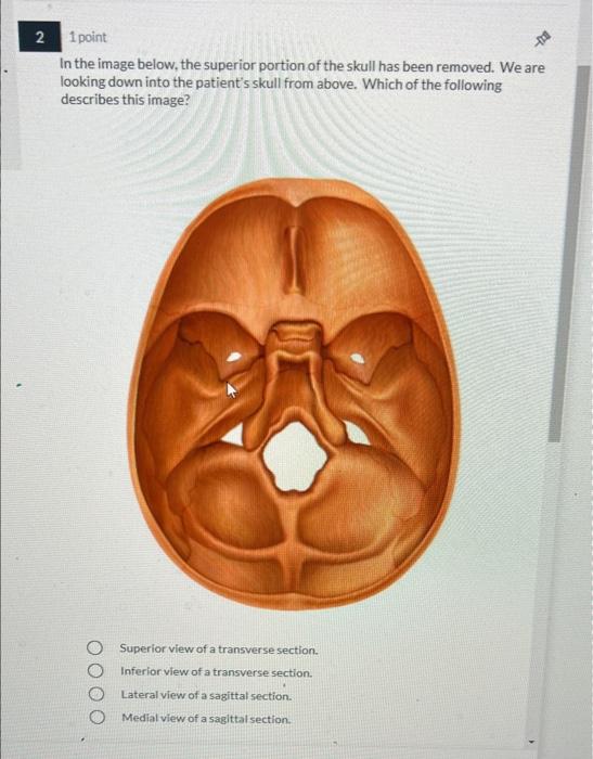 Solved 2 1 point In the image below, the superior portion of | Chegg.com
