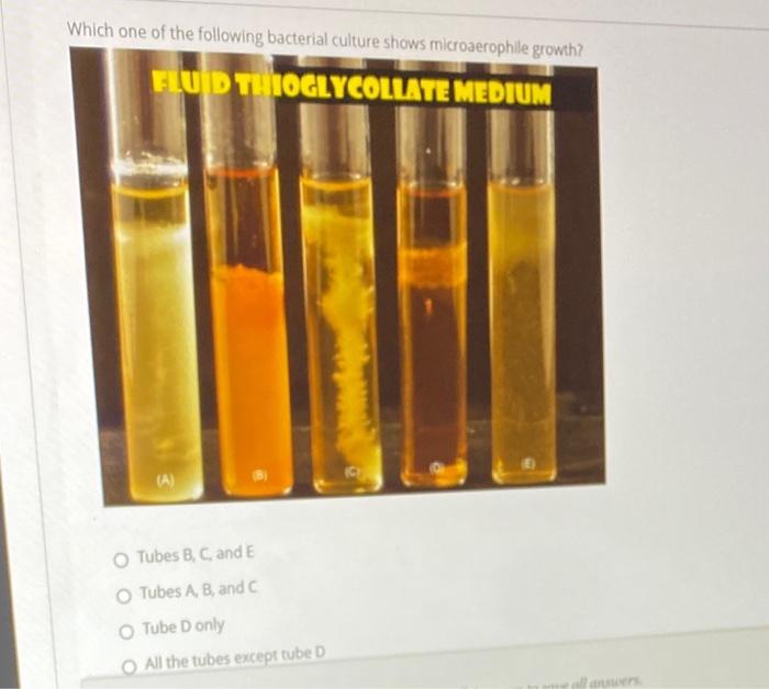 Solved Which one of the following bacterial culture shows | Chegg.com