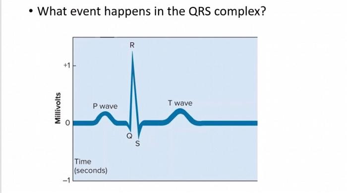 Solved - What event happens in the QRS complex? | Chegg.com