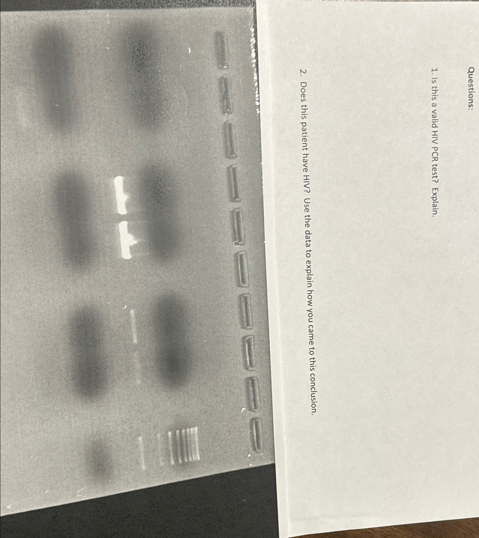 Solved Questions:Is this a valid HIV PCR test? Explain.Does | Chegg.com