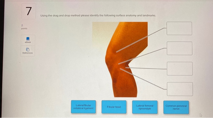 Solved Using the drag and drop method please identify the | Chegg.com Solved Using the drag and drop method please identify the | Chegg.com