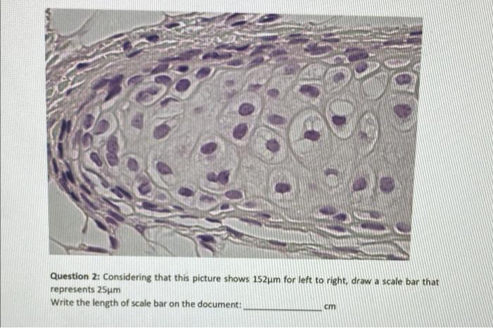 Solved Question 2: Considering that this picture shows 152um | Chegg.com
