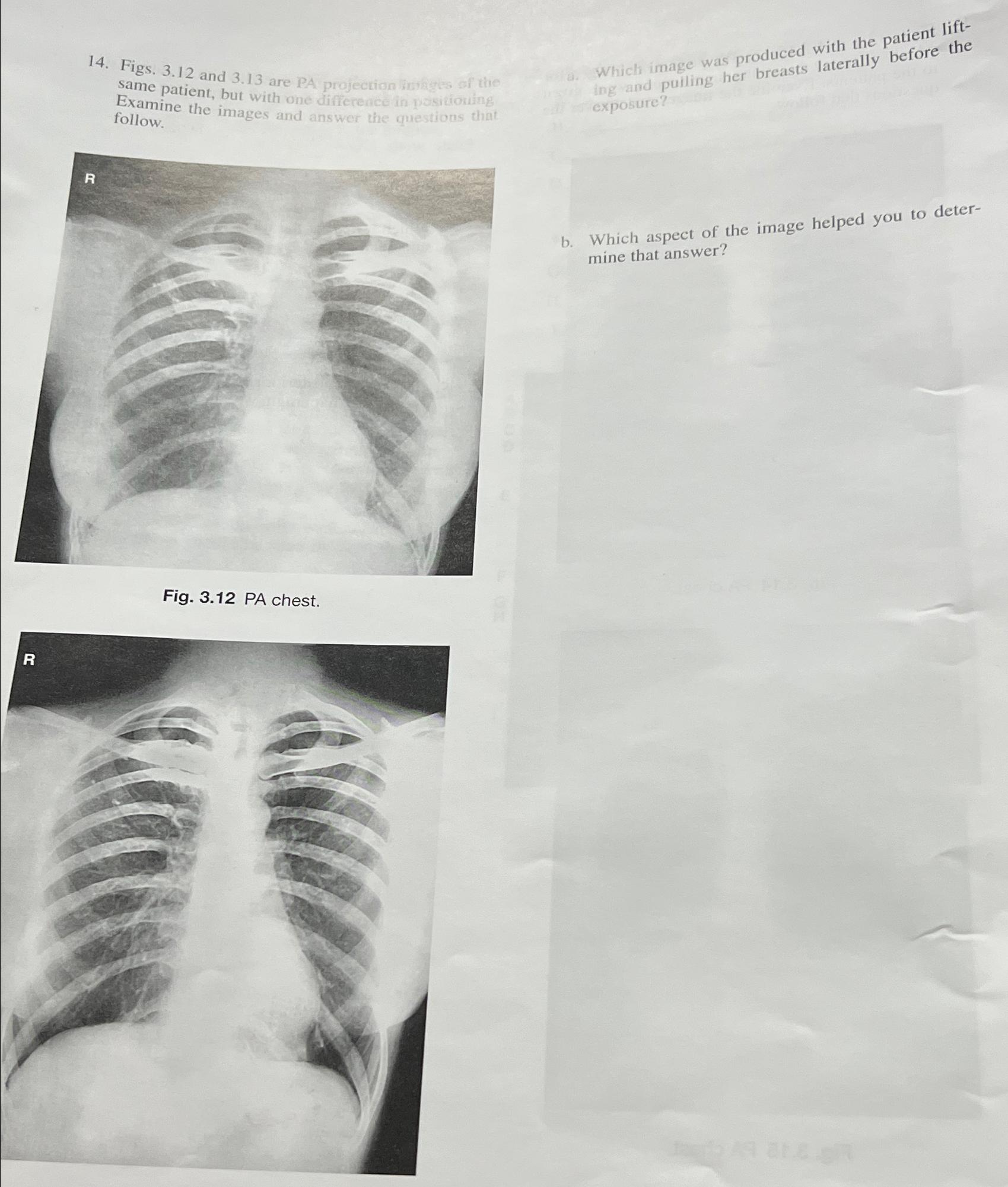 Solved Figs. 3.12 ﻿and 3.13 ﻿are PA projection insiges of | Chegg.com