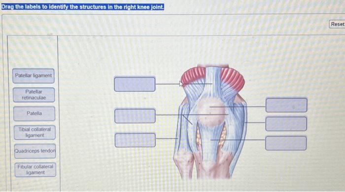 Solved Drag the labels to identify the structures in the | Chegg.com