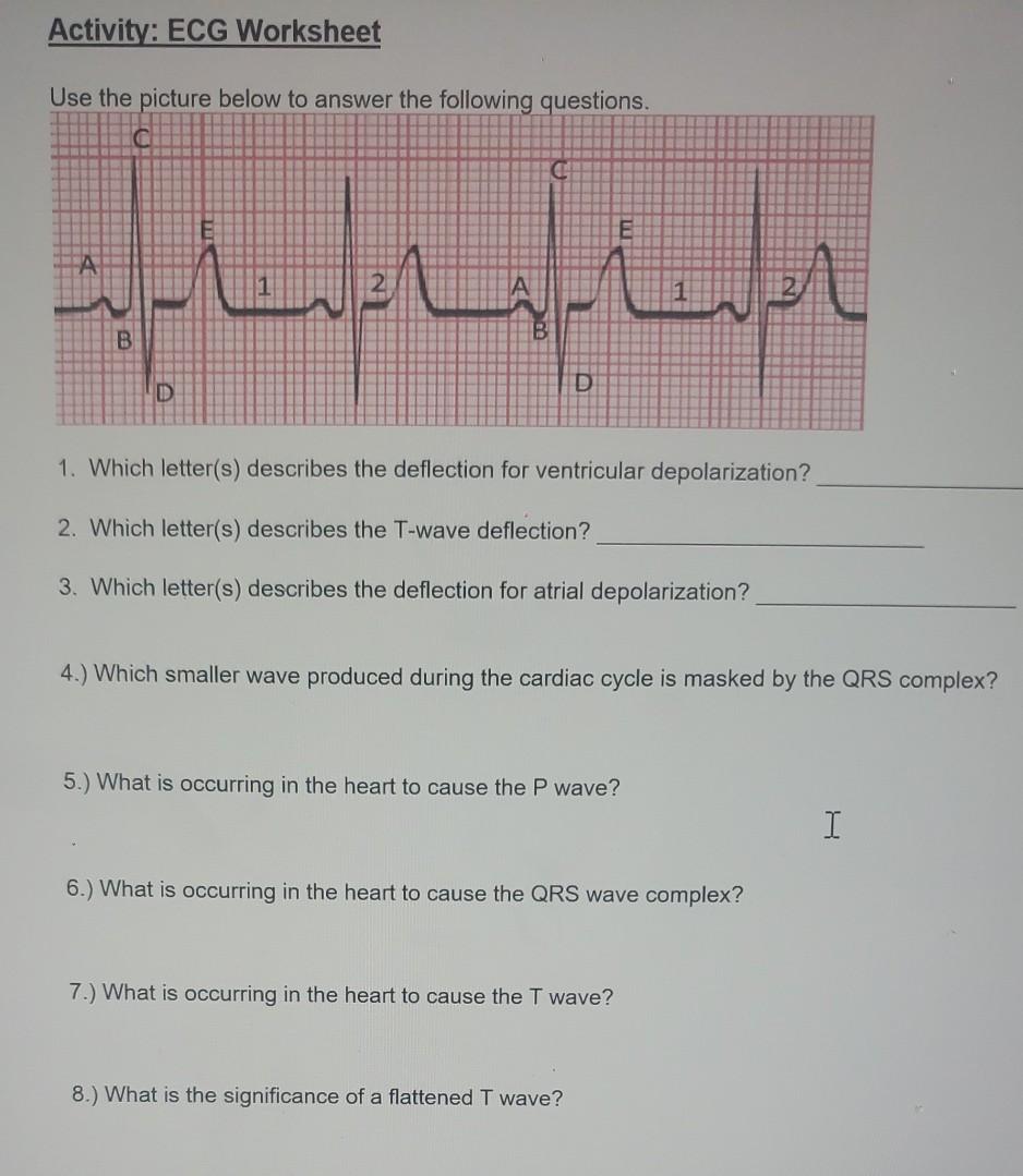 Solved Activity: ECG Worksheet Use the picture below to | Chegg.com Solved Activity: ECG Worksheet Use the picture below to | Chegg.com
