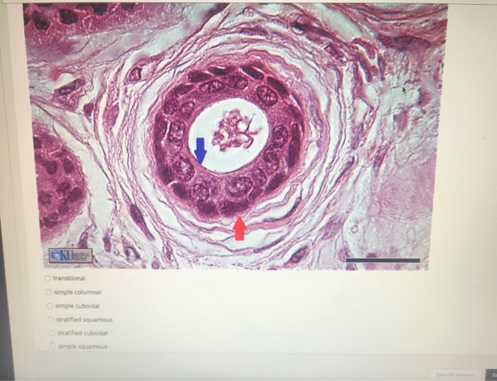 Solved BEK transitional simple columnar simple cuboidal | Chegg.com