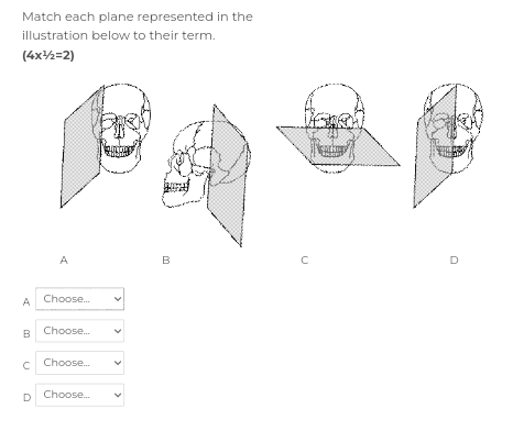 Solved Time left 1:09:33 Question 2 Not yet answered Marked | Chegg.com