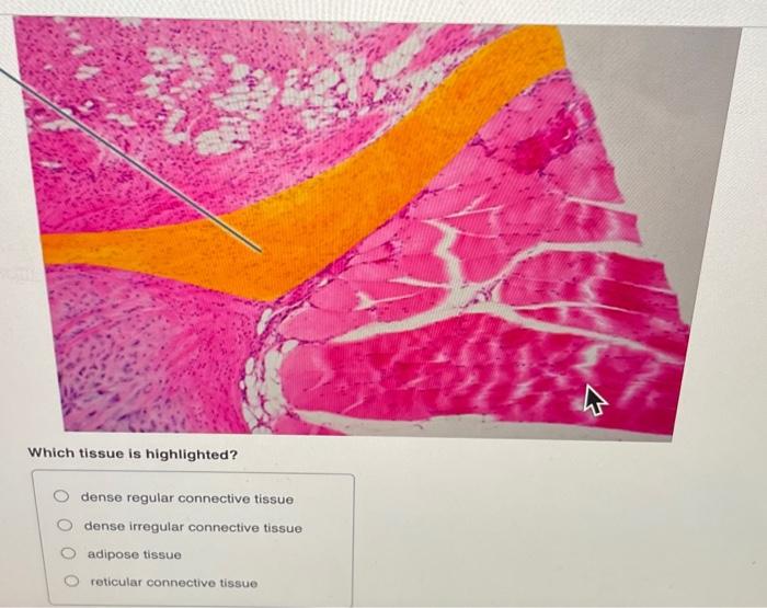 Solved Which tissue is highlighted? dense regular connective | Chegg.com