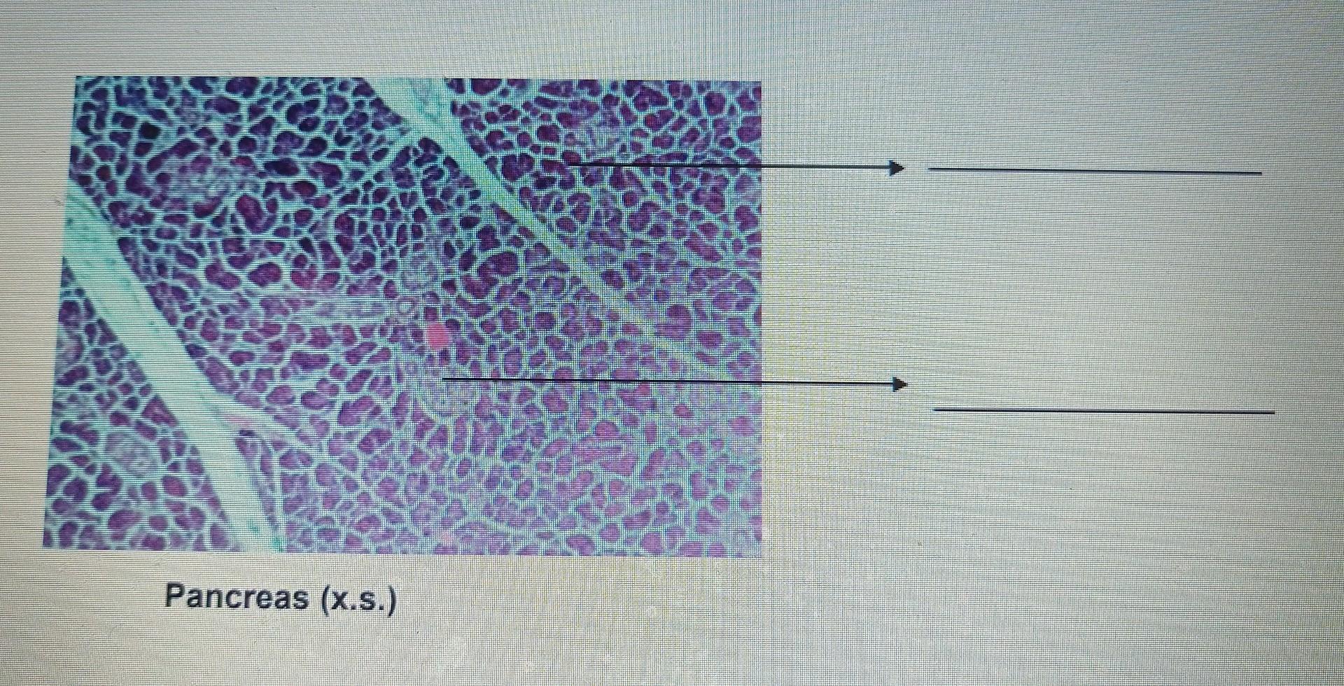 Solved Pancreas (x.s.) | Chegg.com